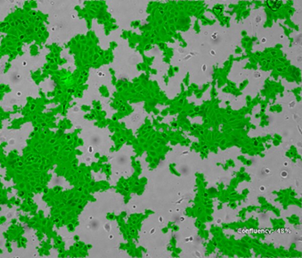 mEER Mouse E6/E7/hRas Oropharynx Epithelial Cell Line | SCC626